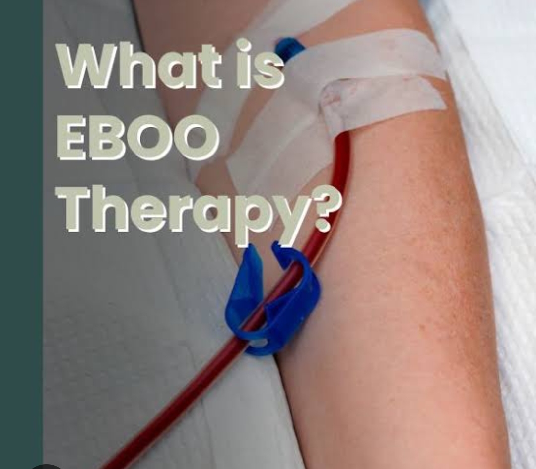 5 Key Benefits of EBOO Therapy: Unlocking Blood Oxygenation